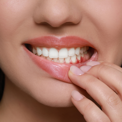 Reconnaître une gencive malade : signes et prévention